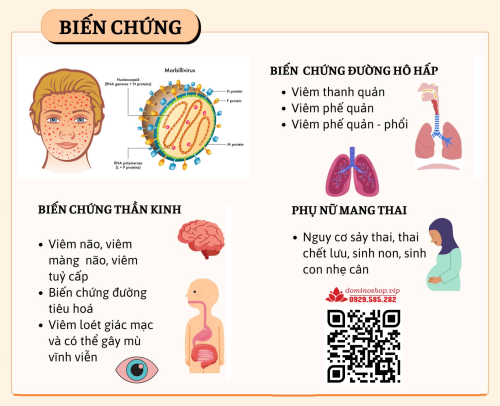 Cách trị bệnh sởi theo đông y cực hiệu quả